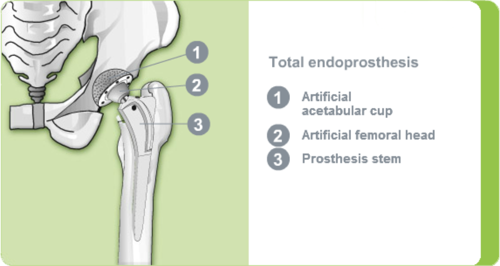 Hip Joint – Anatomy